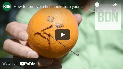 What to do if you suffer these common fishing injuries — FishAndSave